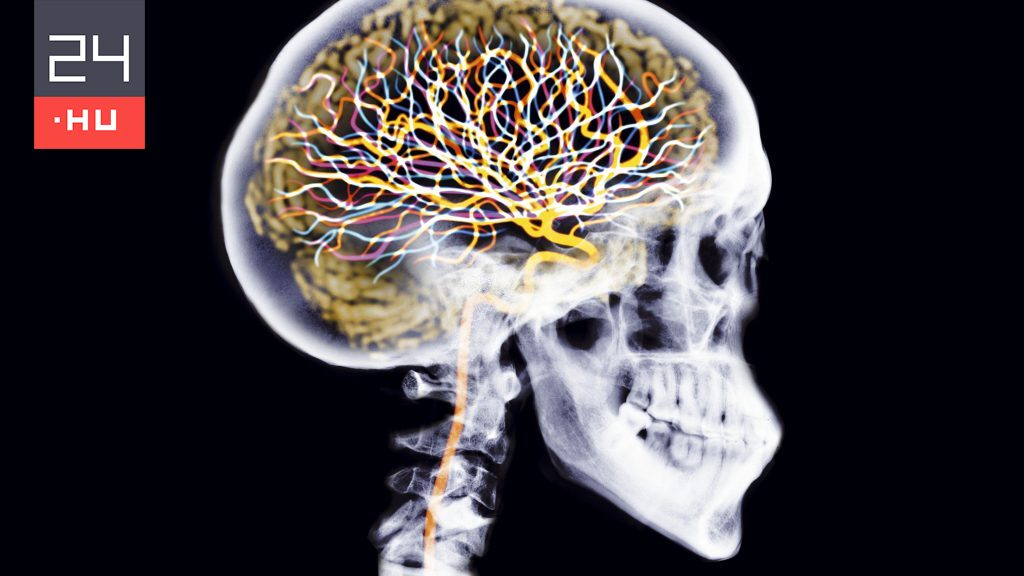 Folyamatosan szivárog az agyunk | 24.hu