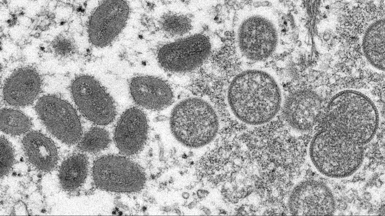 Magyarországon is megjelent a majomhimlő | 24.hu