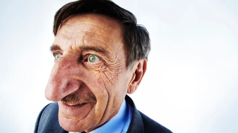 Meghalt a világ leghosszabb orrú embere | 24.hu