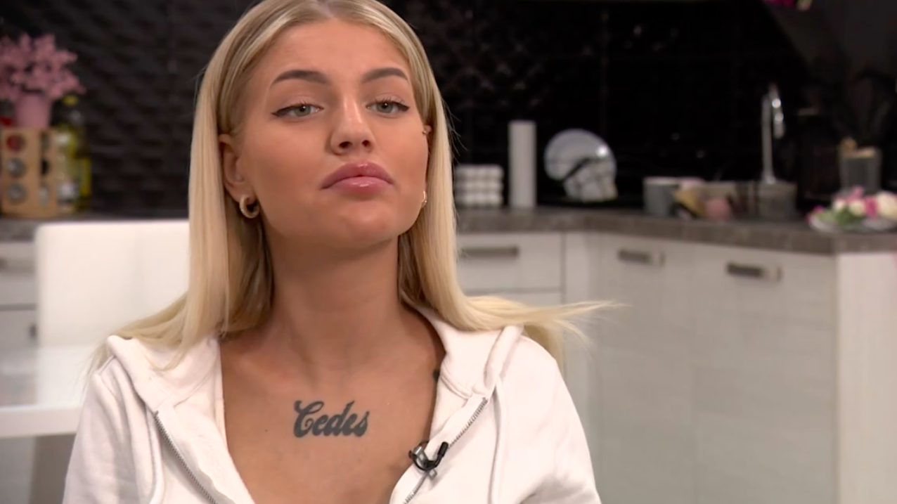 VV Merci sok negatív kommentet kapott az orra miatt, így megműtteti ...