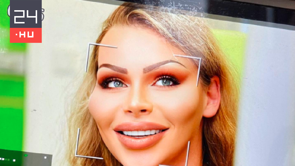 Műanyag babának szeretne látszani a szépségért pokoli kínokat kiálló német férfi | 24.hu