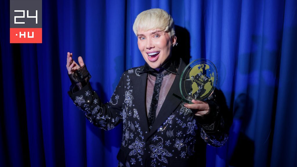 Megbánta, hogy 100 millióból Barbie-vá műttette magát az influenszer ...