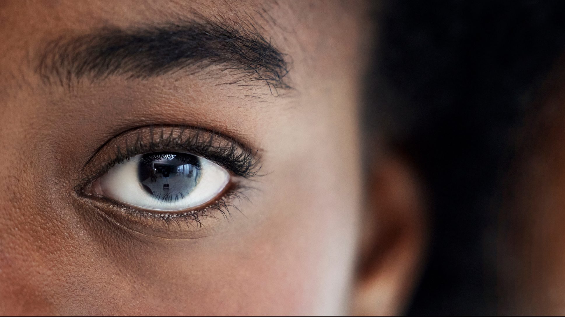 Parazita költözött egy nő szemébe | 24.hu