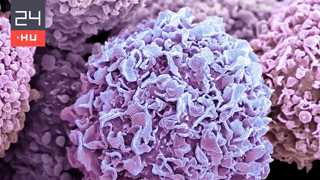 Százéves gyógyszer segíthet a rák elleni harcban | 24.hu